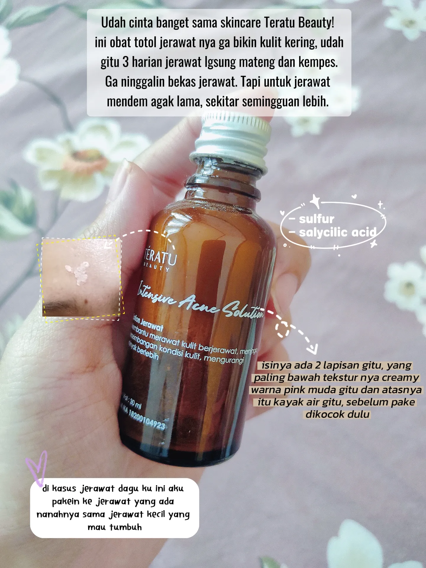 Produk ini bantu sembuhin jerawatku! | Galeri diposting oleh Nadaa🎶 ...