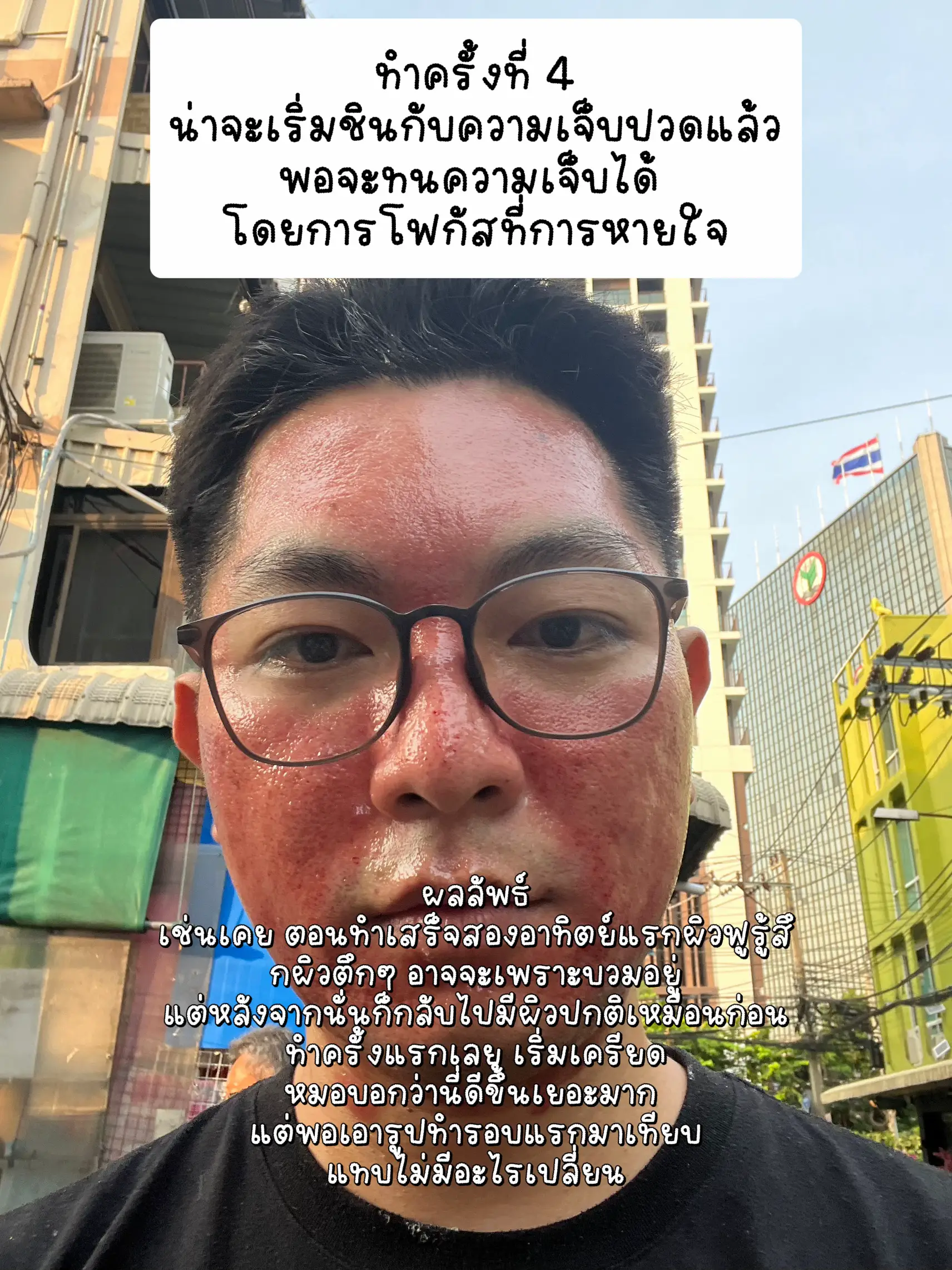 พลีชีพ ทำ PICO 6 ครั้ง แบบไม่มีอะไรเปลี่ยนเลย | แกลเลอรีที่โพสต์โดย Lec ...