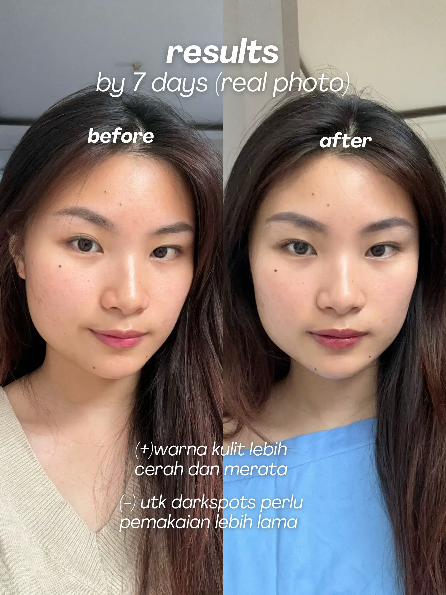 Kulit glowing dalam 7 hari! Ga pake mahal😩 | Galeri diposting oleh Vanes | Lemon8