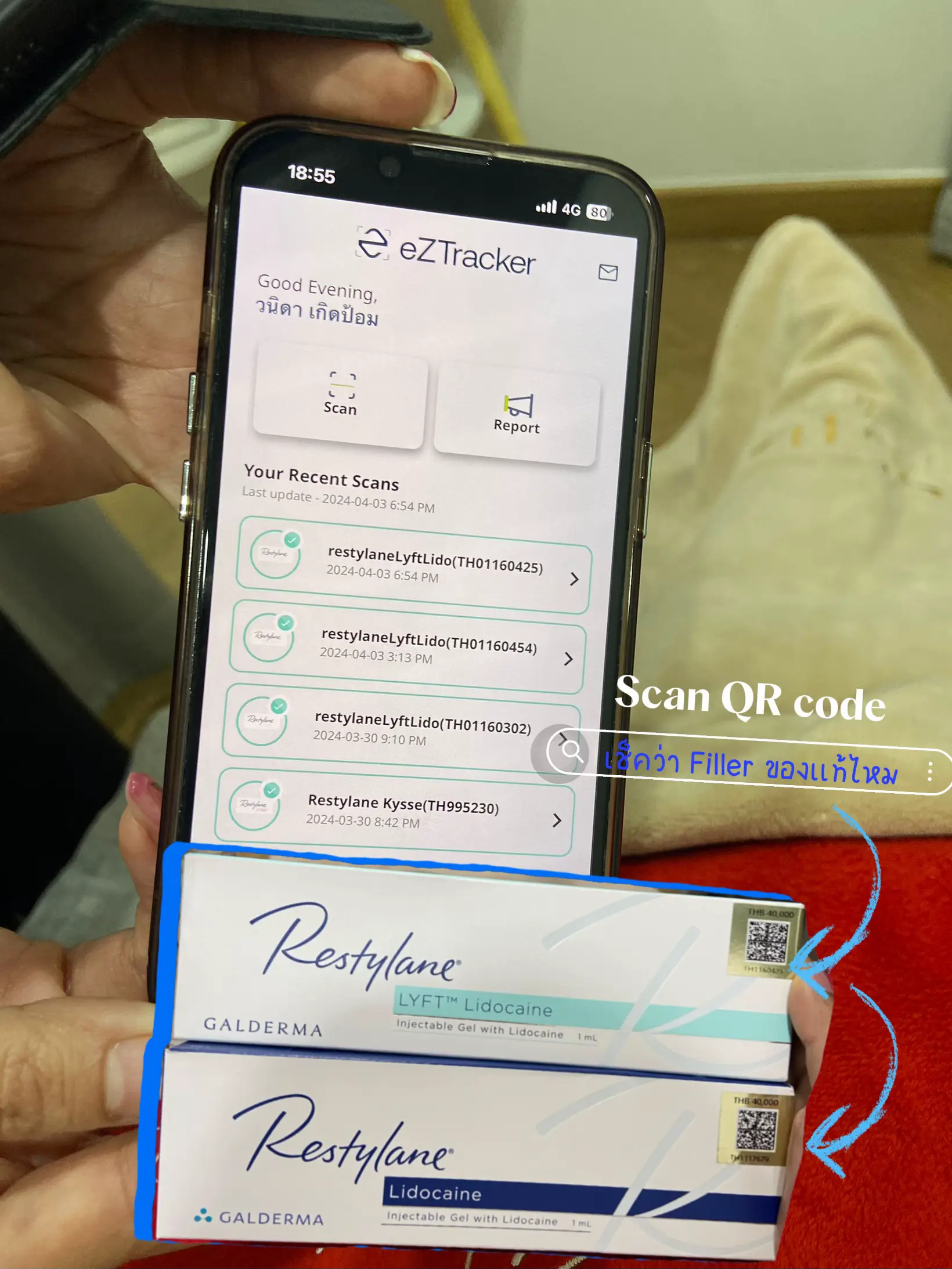 รีวิวฉีดฟิลเลอร์ใต้ตาเเละปาก ฉบับคนฉีดครั้งแรก | แกลเลอรีที่โพสต์โดย Aor Sureeporn | Lemon8