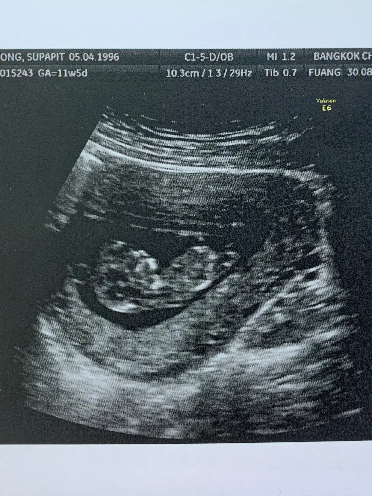 3 Item ช่วยทำให้ท้อง!!!🤰🏻 | แกลเลอรีที่โพสต์โดย หม่าม๊าเมษา | Lemon8