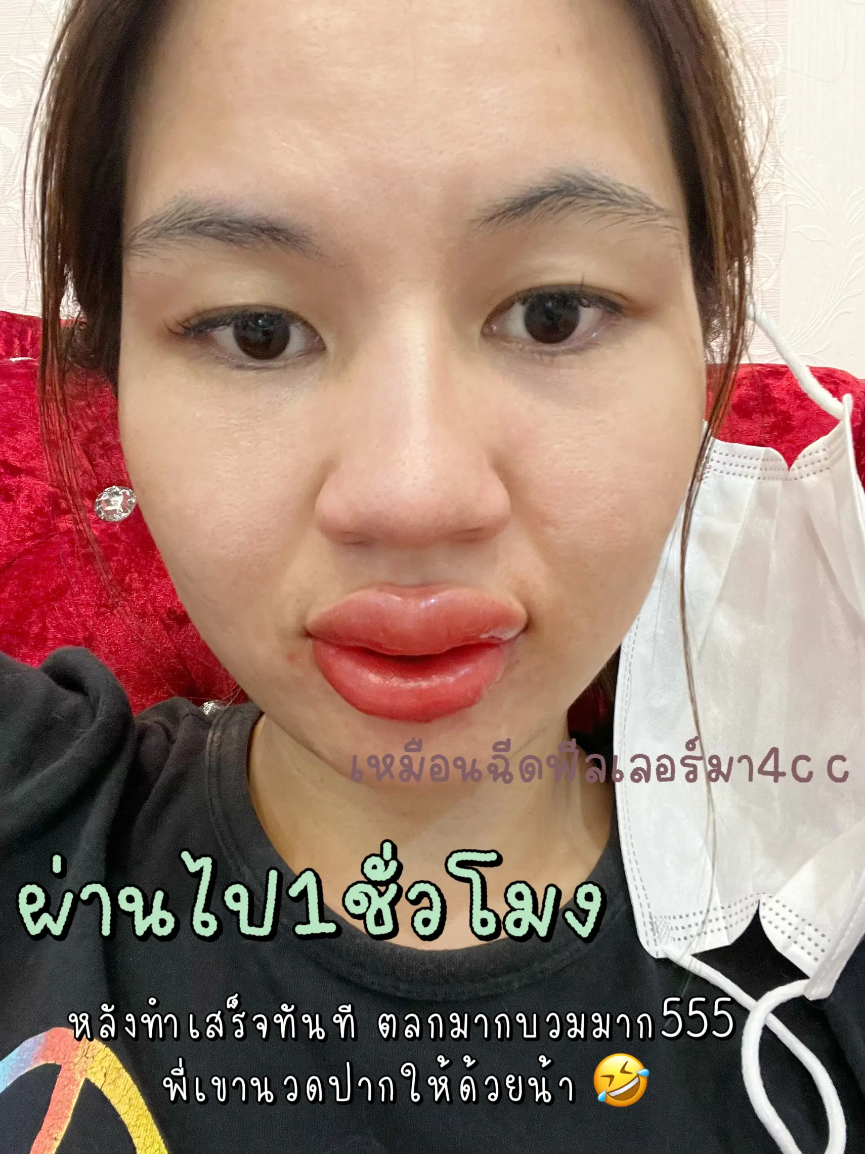 แชร์ประสบการณ์ฝังสีปากจ้า หัวเราะได้นะตามสบาย5555555 🥰 | แกลเลอรีที่โพสต์โดย หมีมาแชร์ | Lemon8