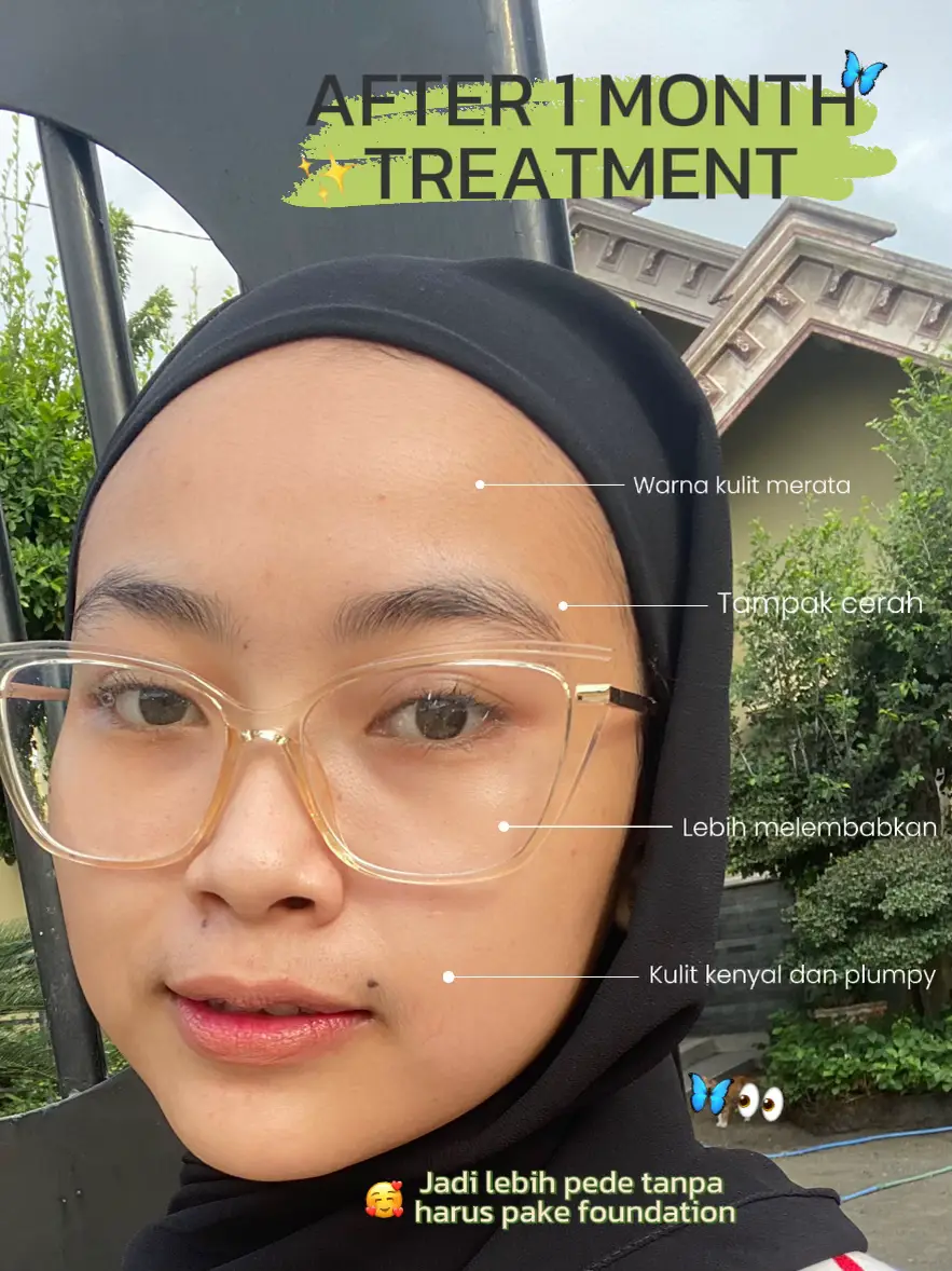 Ketagihan Skin Booster 😫🫰🏻 | Galeri diposting oleh Risma Ayu | Lemon8