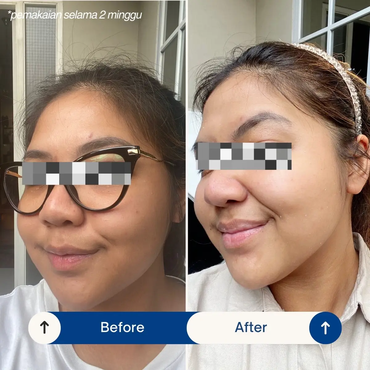 Moisturizer Terbaik 2024 De8 Galeri Diposting Oleh De8 Lemon8