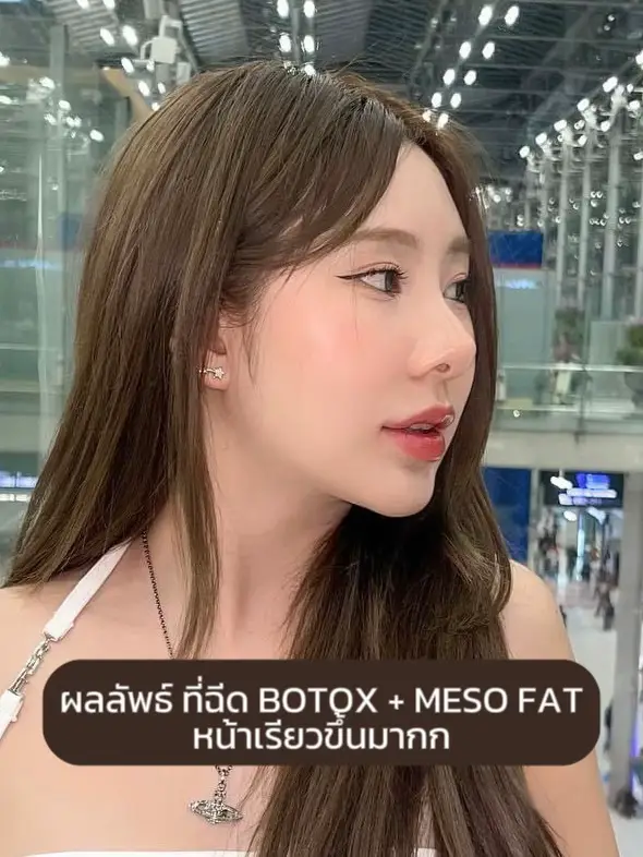 อยากหน้าเรียว BOTOX หรือ MESO FAT ที่ช่วยได้ 🤔 | แกลเลอรีที่โพสต์โดย Hello muse 🪄 | Lemon8