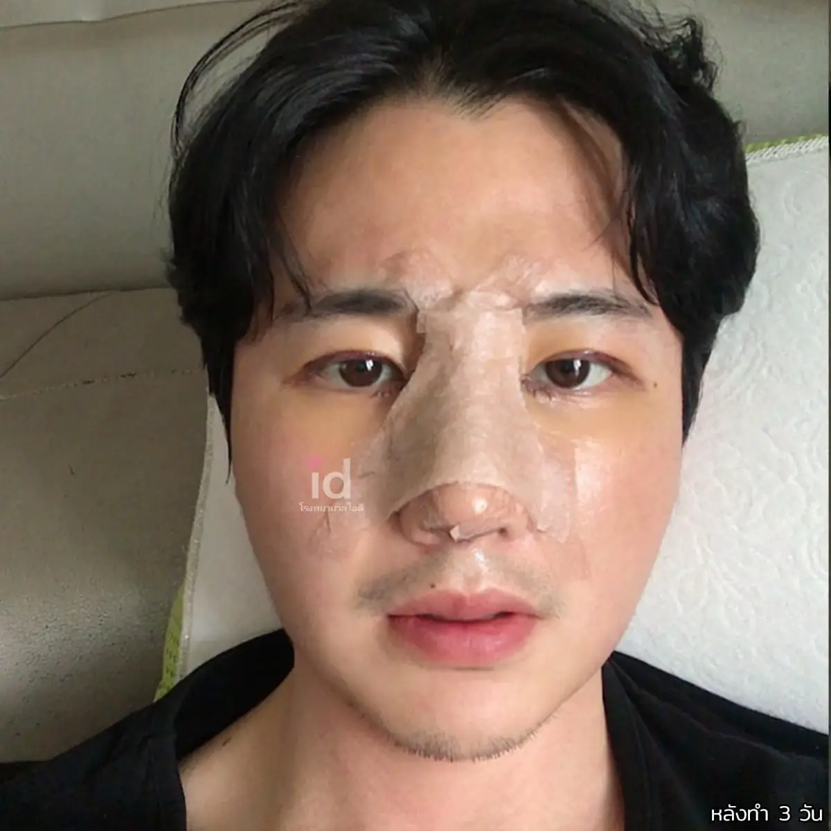 ศัลยกรรมผู้ชาย | แกลเลอรีที่โพสต์โดย Noom BTF | Lemon8