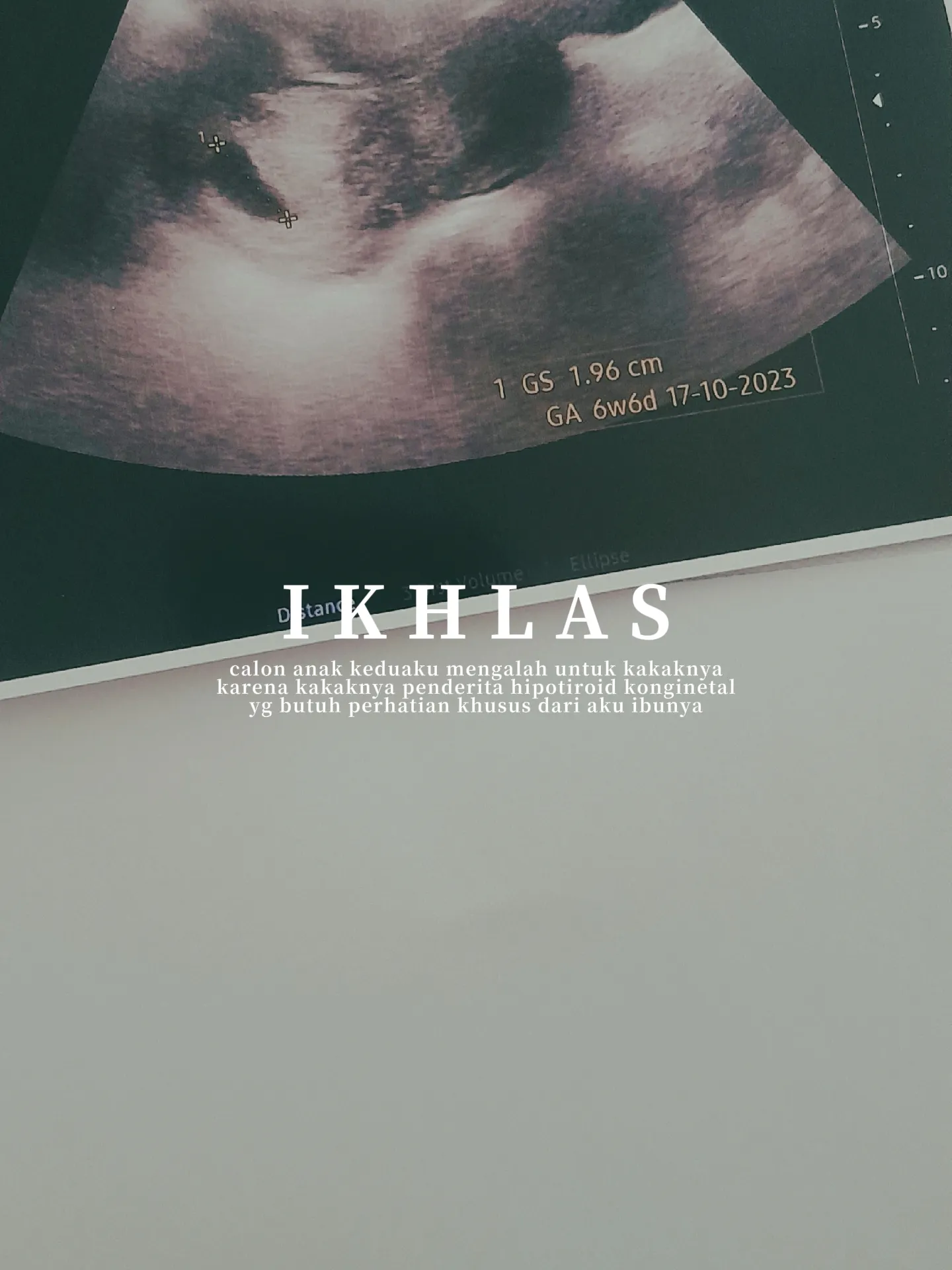 Korban KB Alami | Galeri diposting oleh 𝓼𝓮𝓷𝓳𝓪🍋 | Lemon8