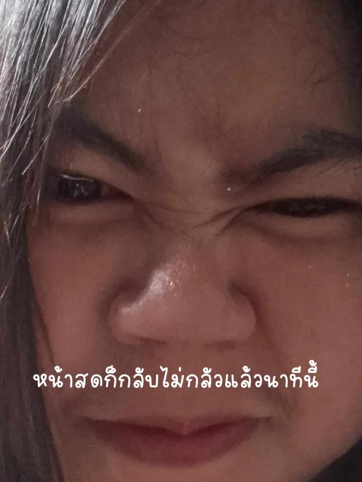 เป็นหนักขนาดนี้จะหายหรอไม่หายหรอกเชื่อดิ? | แกลเลอรีที่โพสต์โดย Diw | Lemon8