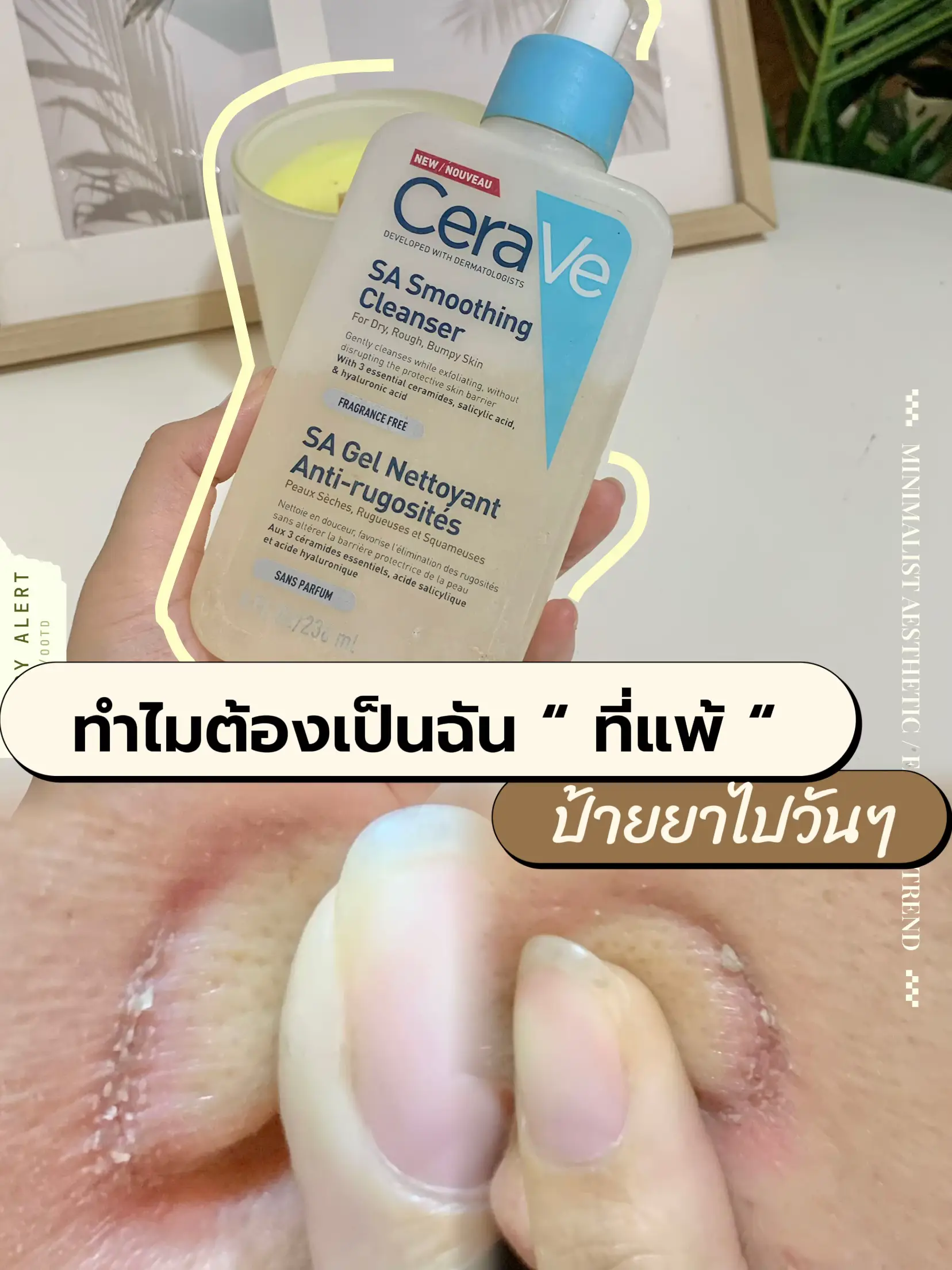 ทำไมต้องเป็นฉัน “ ที่แพ้ “ CERAVE 😭😭😭 | แกลเลอรีที่โพสต์โดย Fah.yupawan | Lemon8