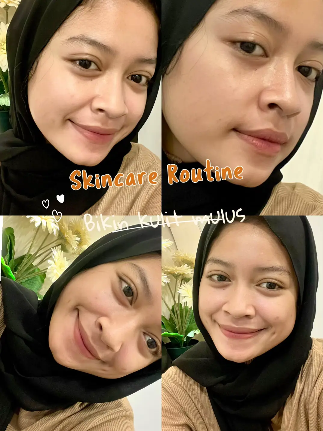 TIPS WAJAH BEBAS JERAWAT DAN NODA HITAM | Galeri diposting oleh yuans♡ ༘ | Lemon8