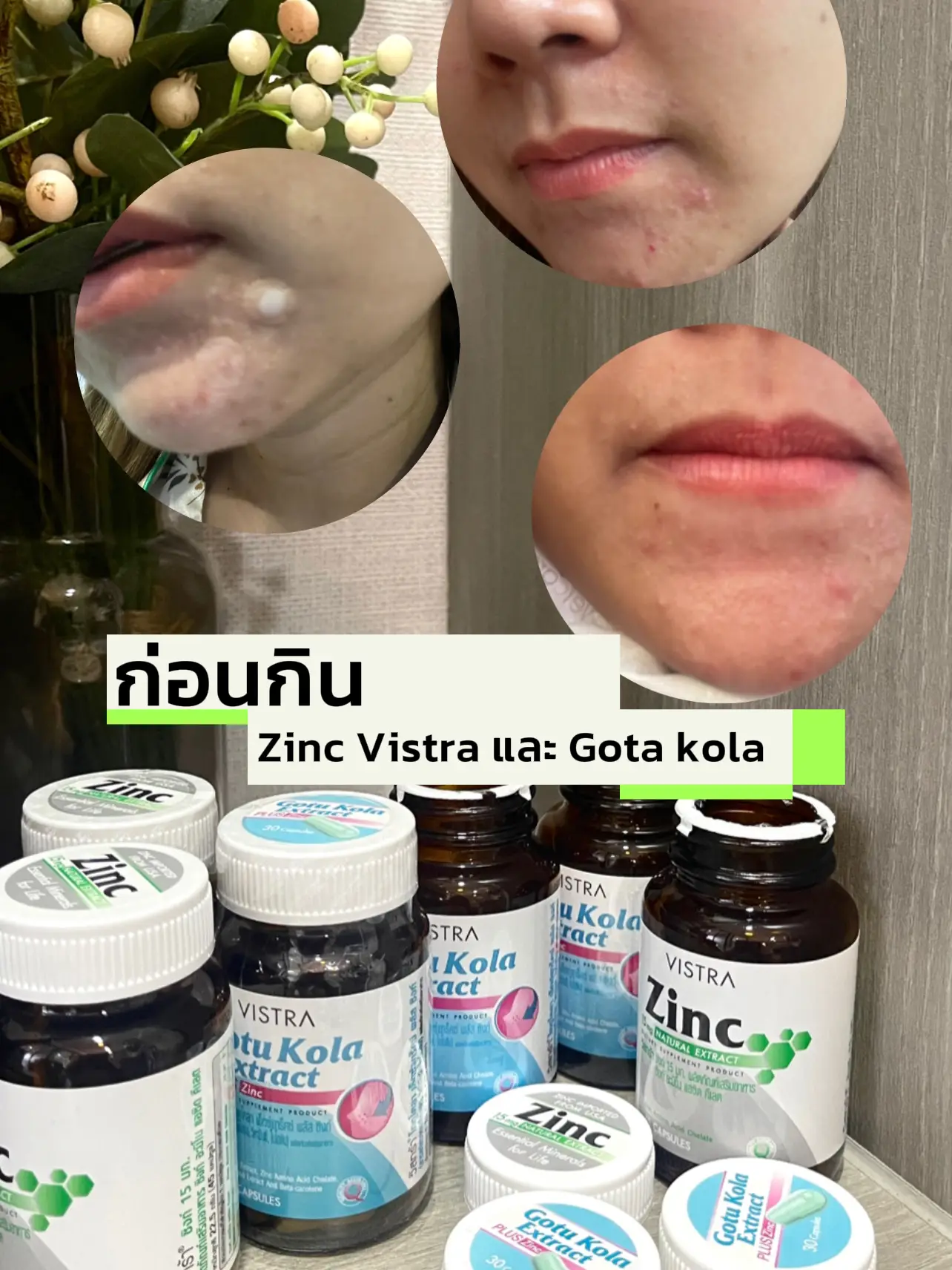 รีวิวzinc - การค้นหาใน Lemon8