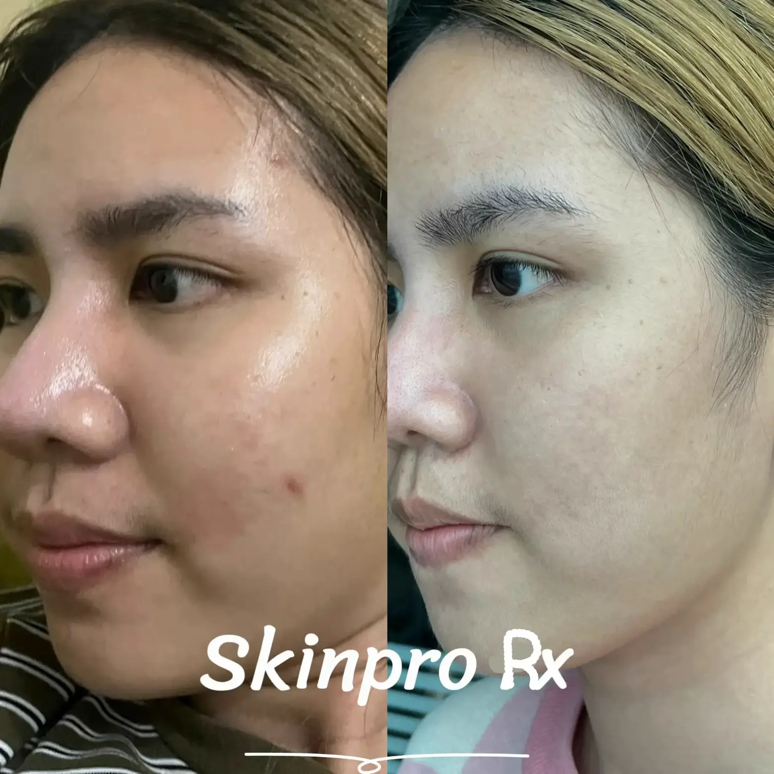 Skinpro Rx เจลล้างหน้าที่เลิฟที่สุด | แกลเลอรีที่โพสต์โดย PJSahutsaya ...