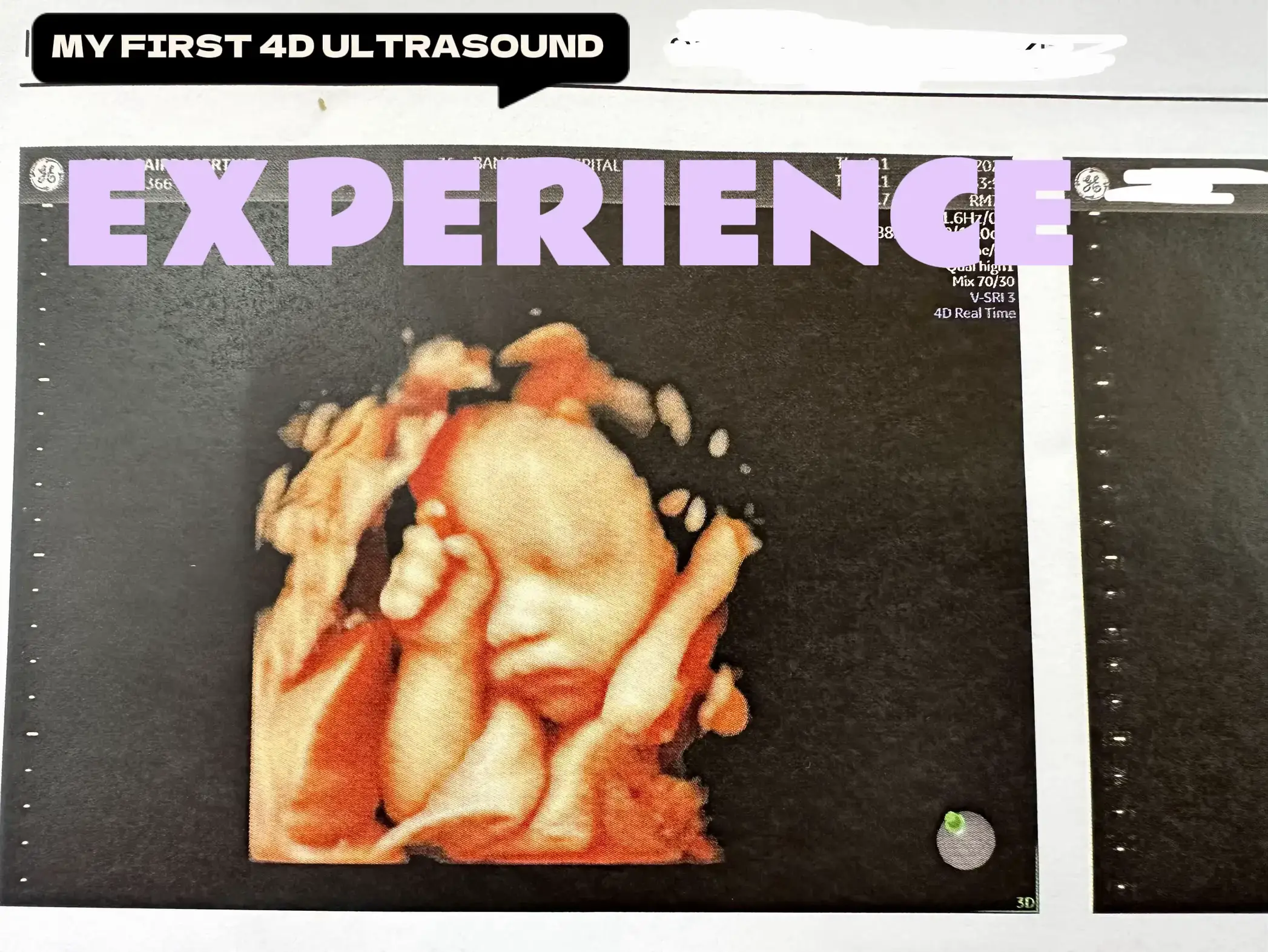 My 4D ultrasound ซาว4 มิติเห็นอะไรบ้าง | แกลเลอรีที่โพสต์โดย Honey Bee ...