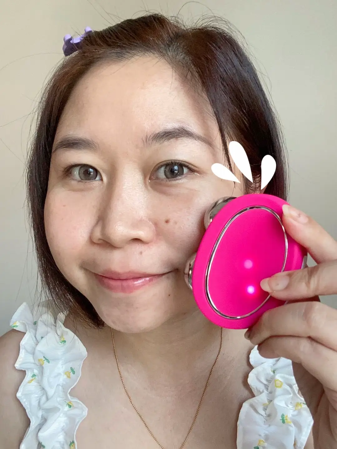 หลังใช้เป็นไง! เครื่องยกกระชับผิวหน้า FOREO BEAR | แกลเลอรีที่โพสต์โดย Poly.Reen | Lemon8