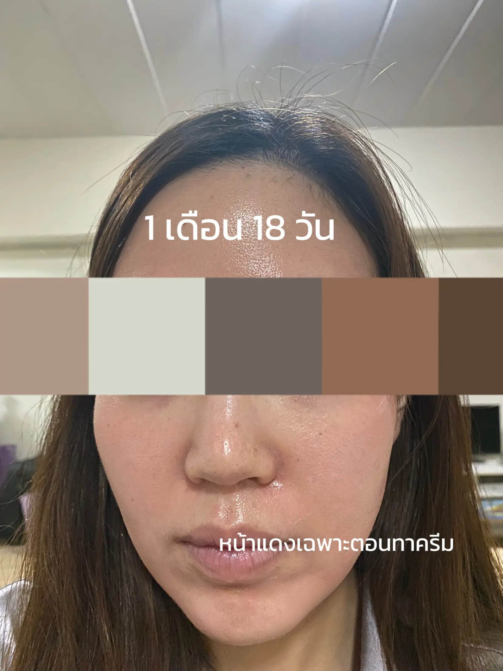 Review พลีชีพ ครีมรักษากระ cosmelan2 | แกลเลอรีที่โพสต์โดย Pupoo Prey | Lemon8