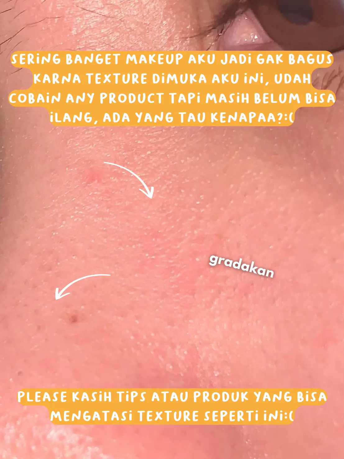 Ada Yang Tau Cara Ngilangin Texture Di Area ini?? | Galeri diposting ...