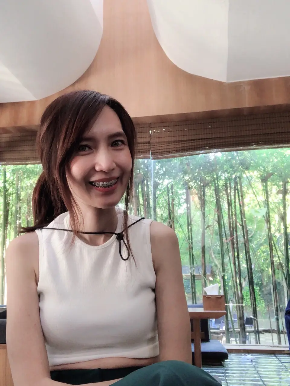 Ep.4 ครบ 3 เดือน หลังผ่าตัดขากรรไกร หน้าเข้าที่ เป๊ะเวอร์😃 | แกลเลอรีที่โพสต์โดย PpSAmE | Lemon8