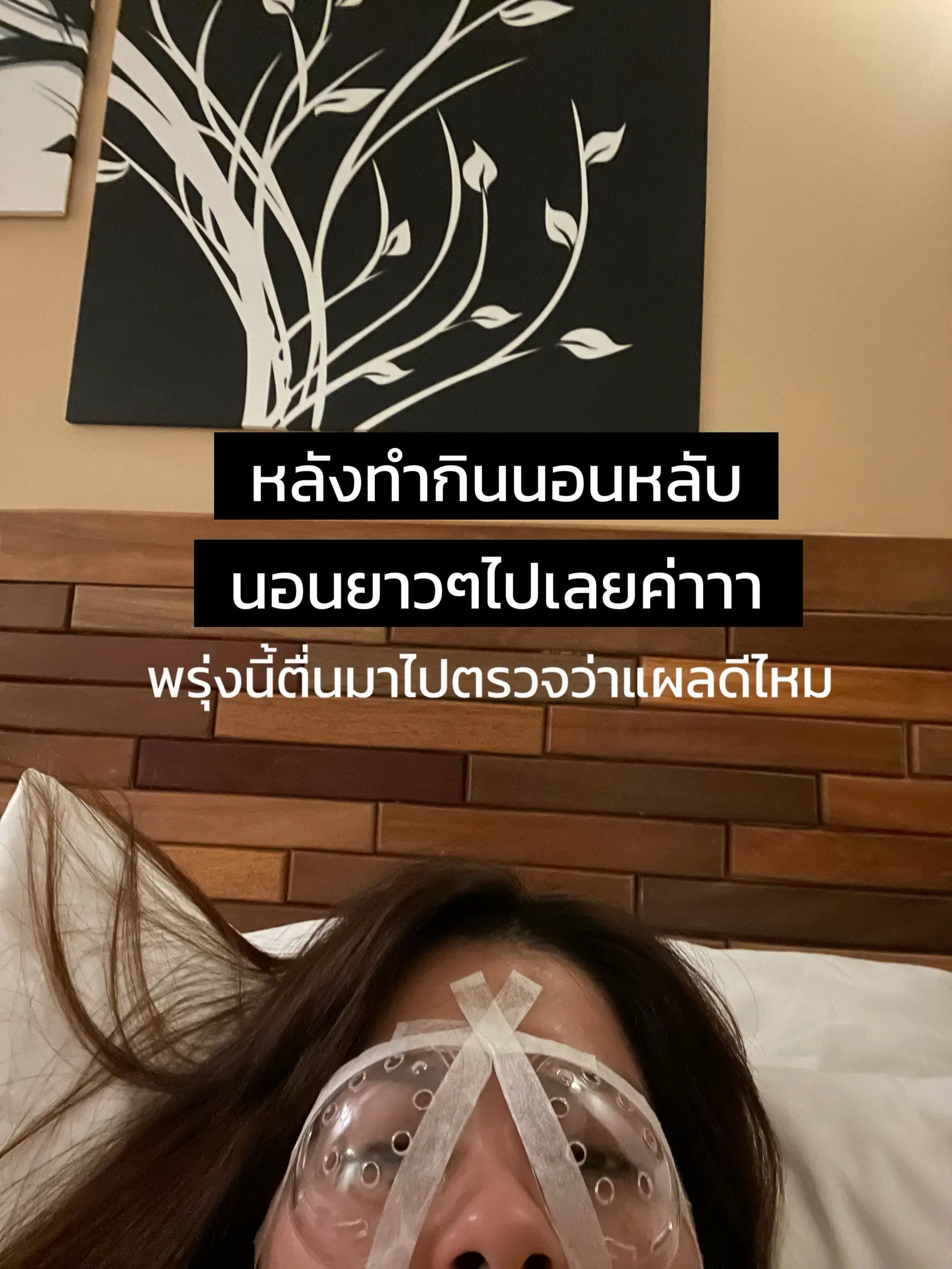 จ่ายจบ FemtoLASIK ไป 56,000.- คุ้มไหม | แกลเลอรีที่โพสต์โดย สวยค่ะซิส ...