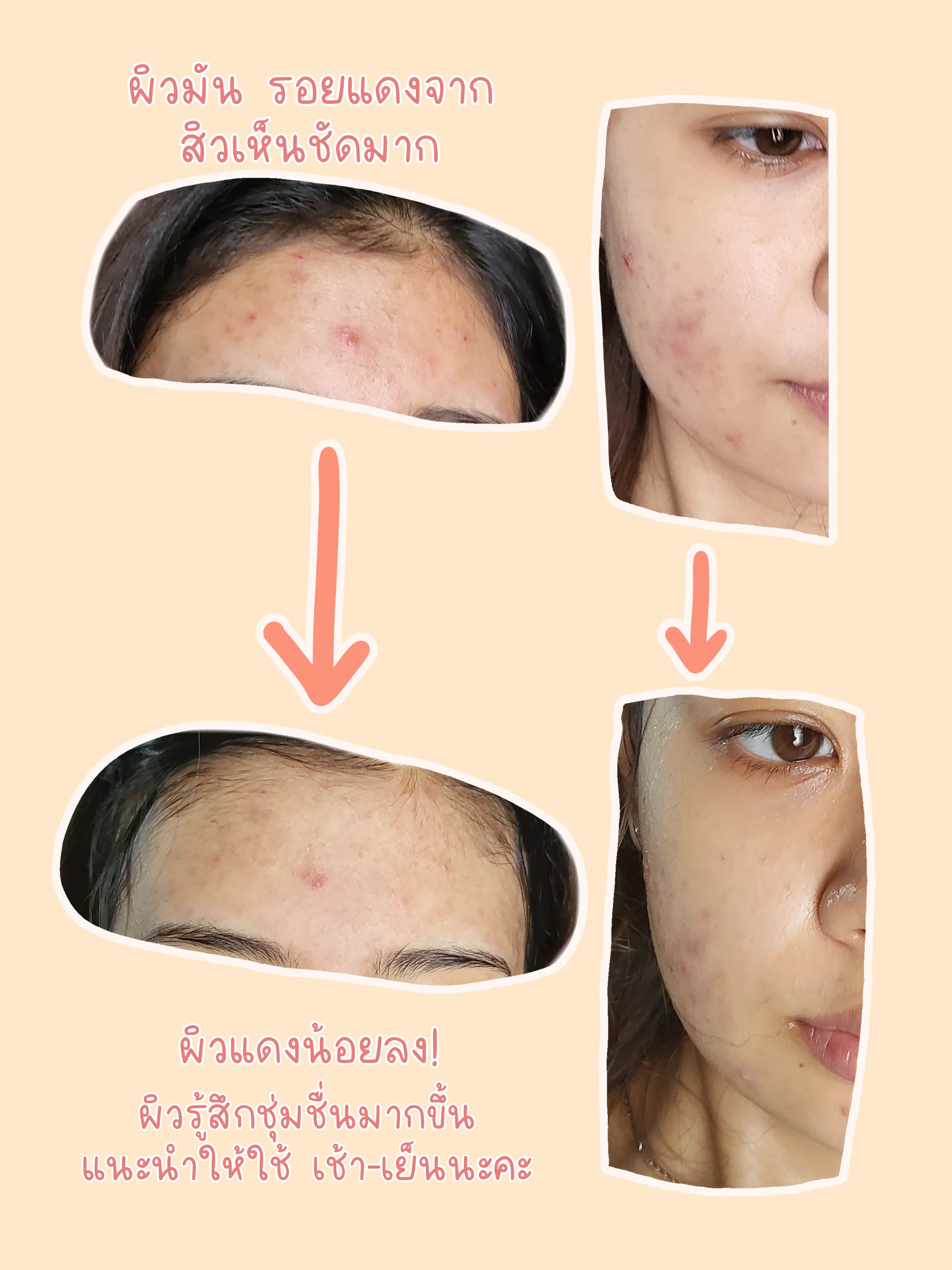 โทนเนอร์น้ำซาวข้าว! | แกลเลอรีที่โพสต์โดย soya! | Lemon8