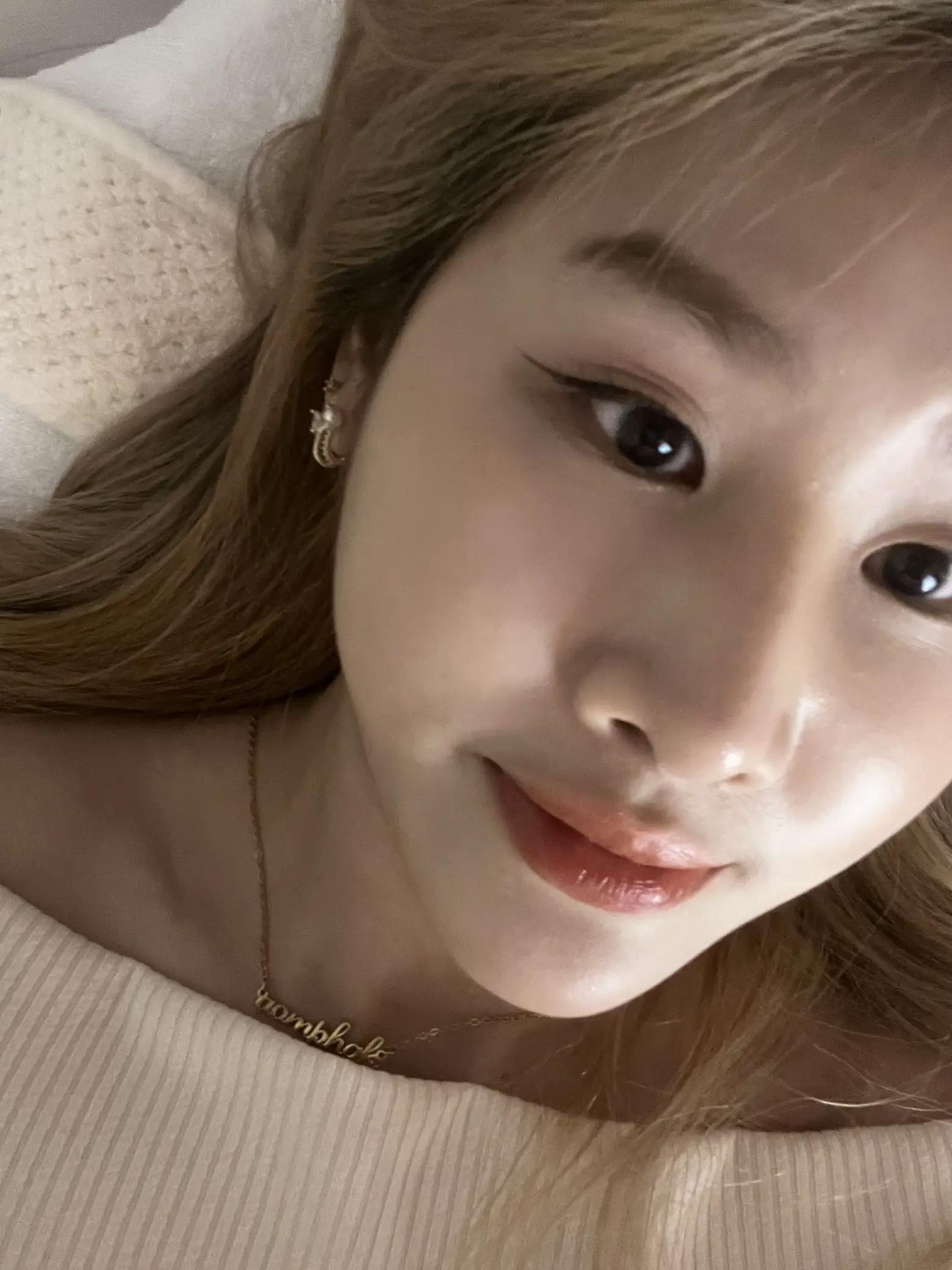 Botox แต่ละจุดควรใช้กี่ยูนิต?| โฆษณาเกินจริงที่ต้องรู้ก่อนโดนหลอก | แกลเลอรีที่โพสต์โดย Kkacha ...