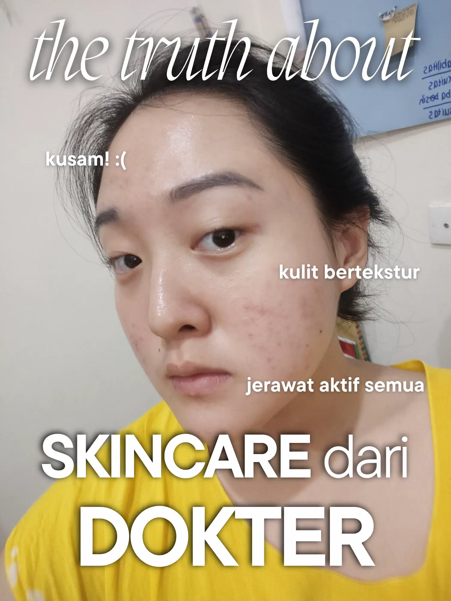 Real Experience Aku Pake Skincare Dokter 👩🏻‍⚕️ | Galeri diposting oleh ...