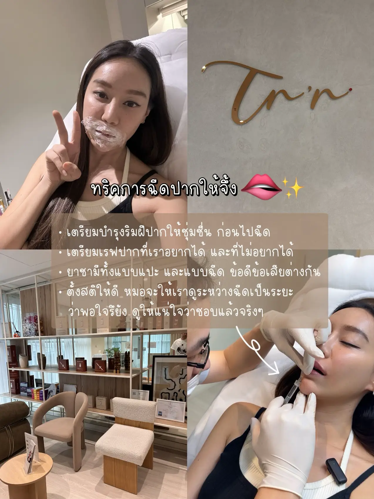 ฟิลเลอร์ปากครั้งแรก 1000/10 🫦 | แกลเลอรีที่โพสต์โดย riin.journey🧸🌻 | Lemon8