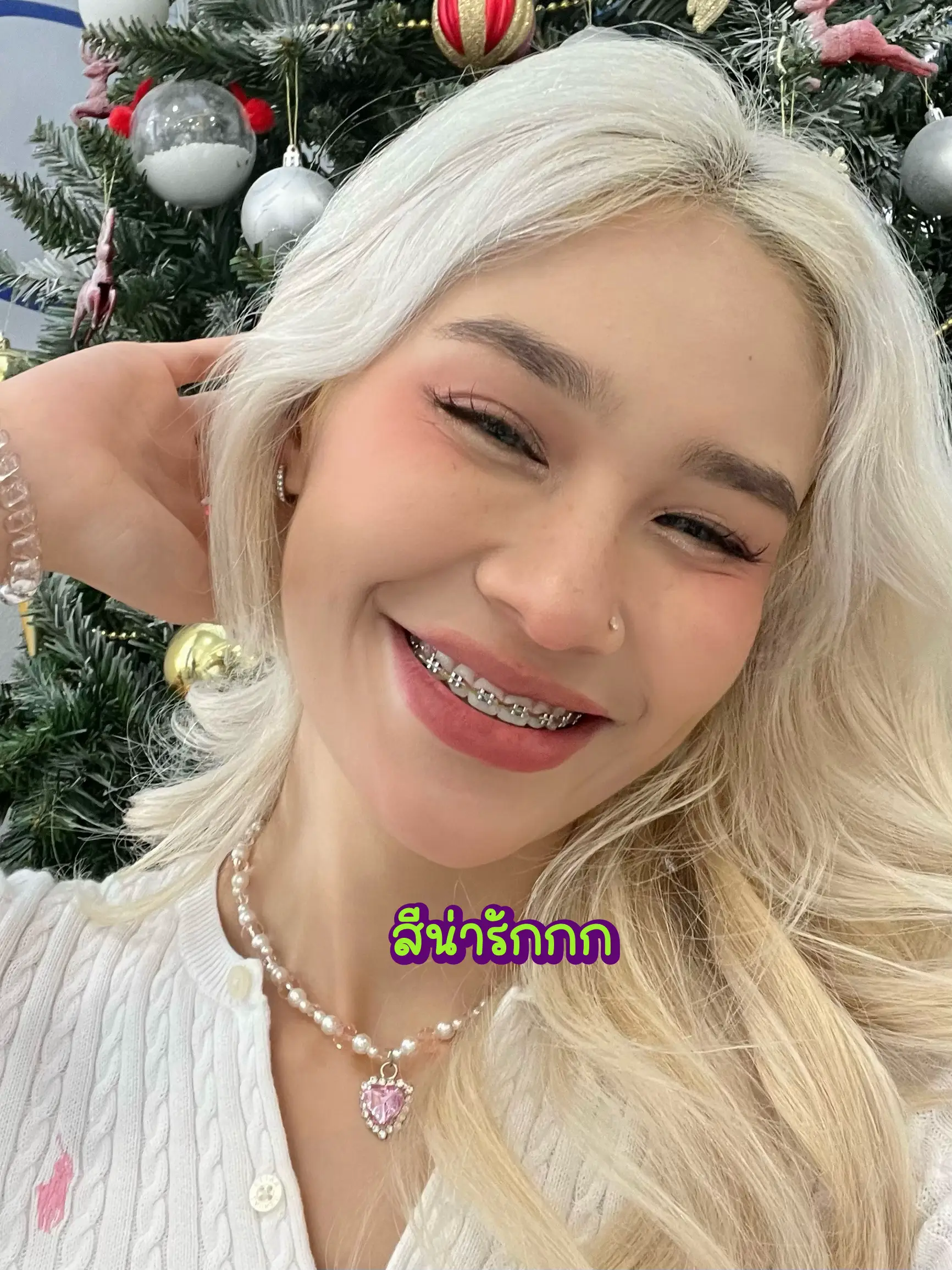 💜แนะนำสียางจัดฟันสีโทน Kuromi X Keroppi💚 | แกลเลอรีที่โพสต์โดย Helen 💖 | Lemon8