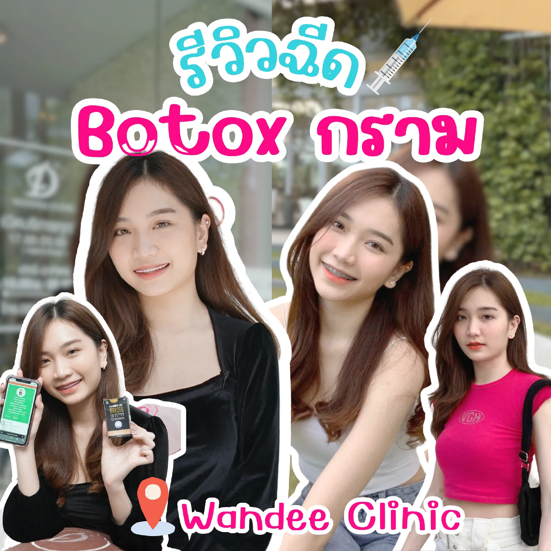 💉 รีวิวฉีดโบท็อกซ์ลดกราม ครั้งแรก เป็นยังไงมาดู 😍 | แกลเลอรีที่โพสต์โดย Wandee Clinic | Lemon8