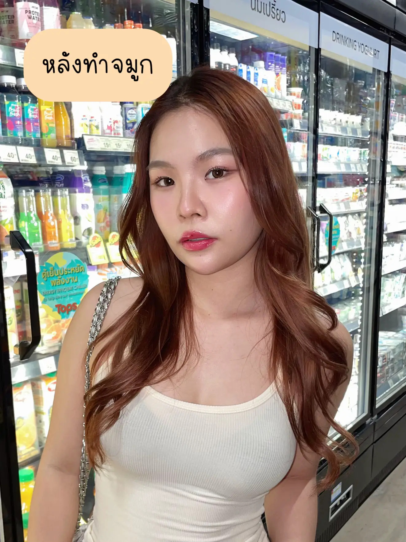 ก่อน-หลังเสริมจมูก |รู้งี้ทำนานแล้ว! งบ9xxx.- | แกลเลอรีที่โพสต์โดย Ployy_pwnii | Lemon8
