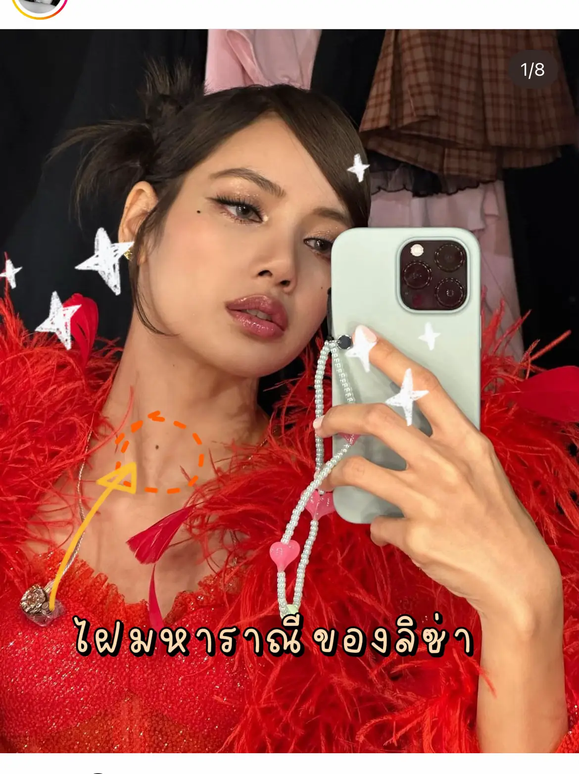 ไฝมหาราณี ขึ้นมาตอนฉัน 32 ขวบ | แกลเลอรีที่โพสต์โดย Ma riam | Lemon8