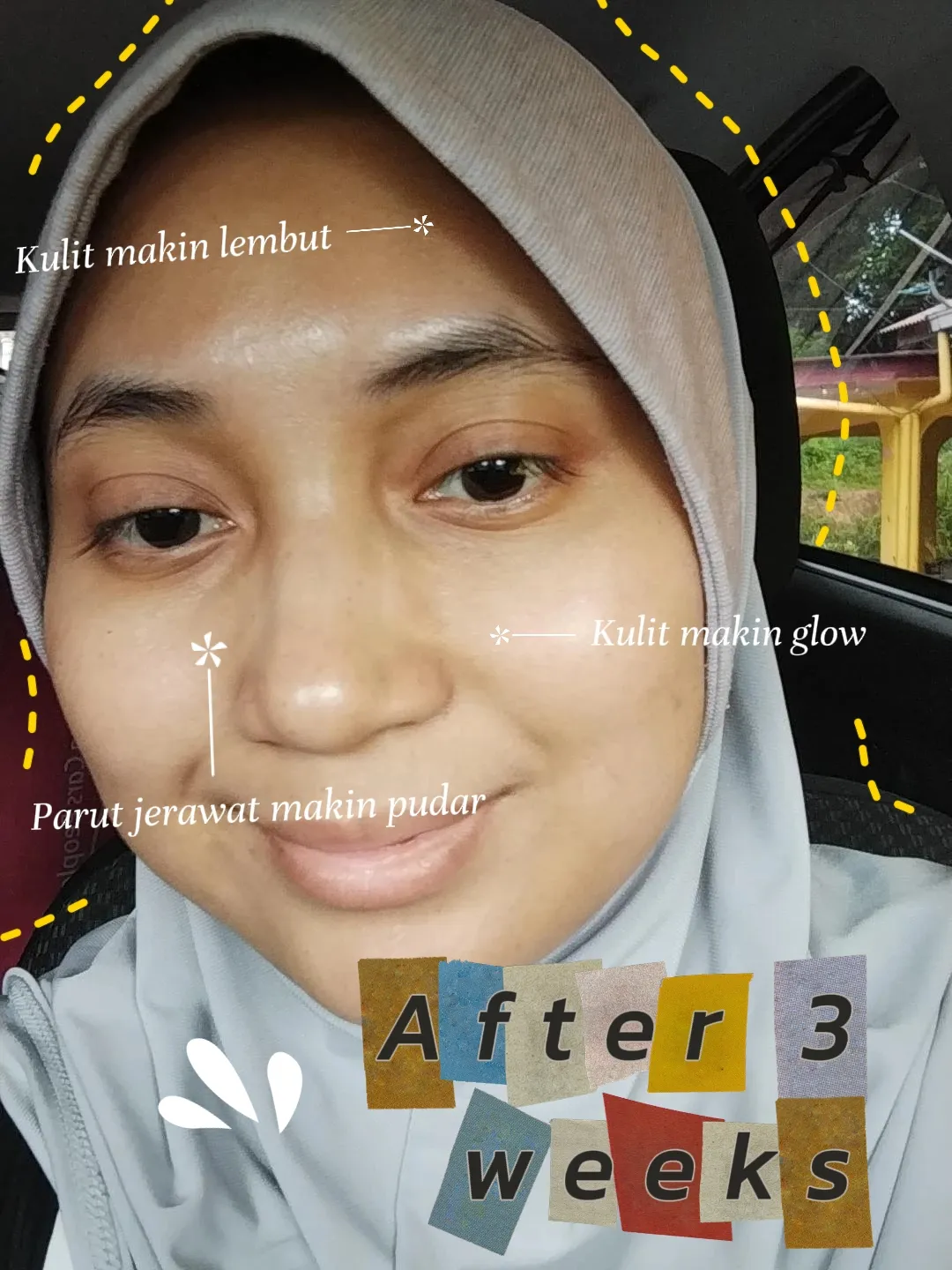 Why I fall in love 💗 with cosmoderm | แกลเลอรีที่โพสต์โดย Mac Namy | Lemon8