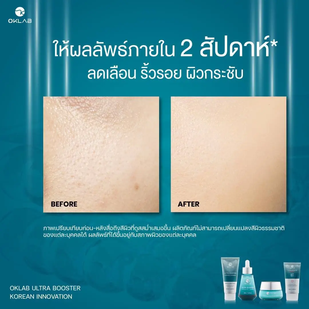 ใครอยากมีผิวเนียนใส ไร้จุดด่างดำฟังทางนี้!!! | แกลเลอรีที่โพสต์โดย ...