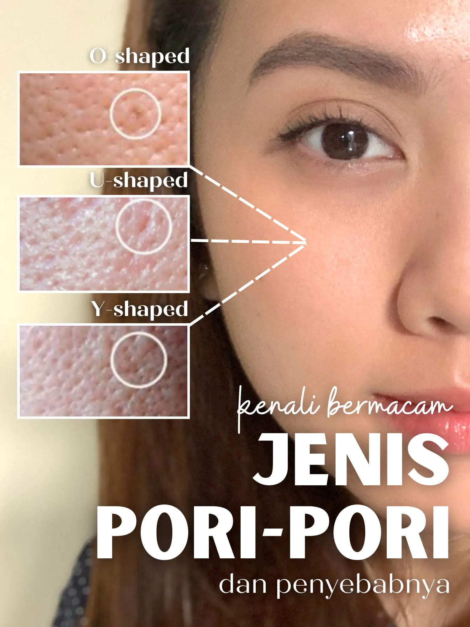 Kenali jenis pori-pori! Kamu yang mana nih?🫣 | Galeri diposting oleh Athaya Ismail | Lemon8