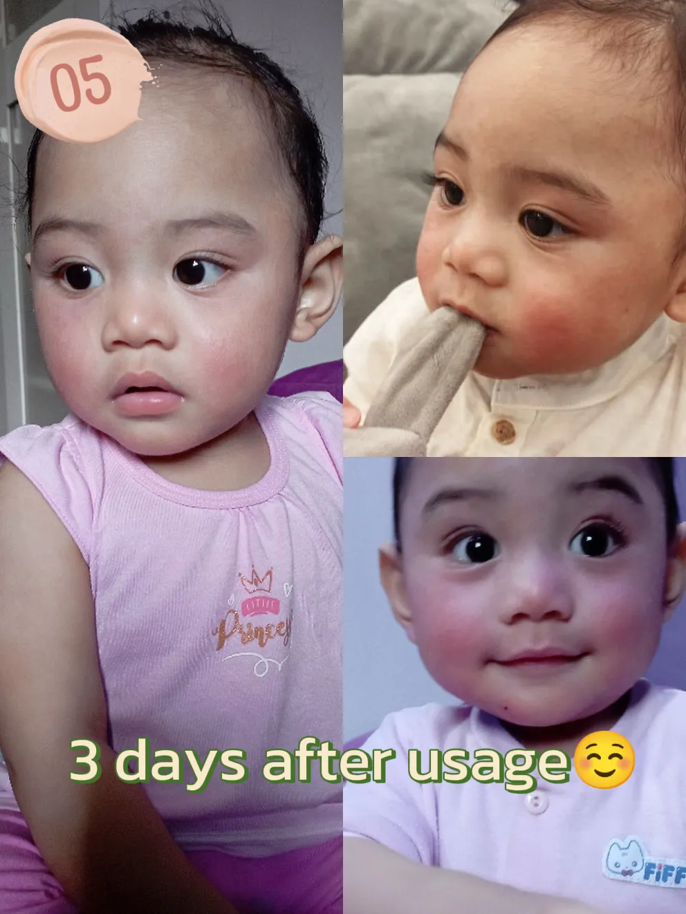My baby glow up journey👶🏻 | แกลเลอรีที่โพสต์โดย MommyNayla🌼 | Lemon8