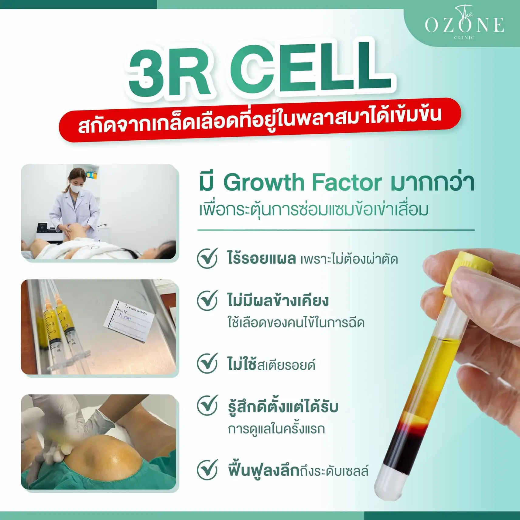 Treat knee osteoarthritis with own blood.🩸 | Gallery posted by The ozone | Lemon8