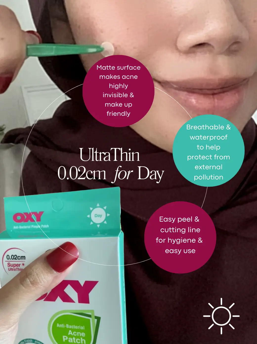 Big Event / Ocacasion Saviour : Oxy Acne Patches! | แกลเลอรีที่โพสต์โดย Anna S | Lemon8