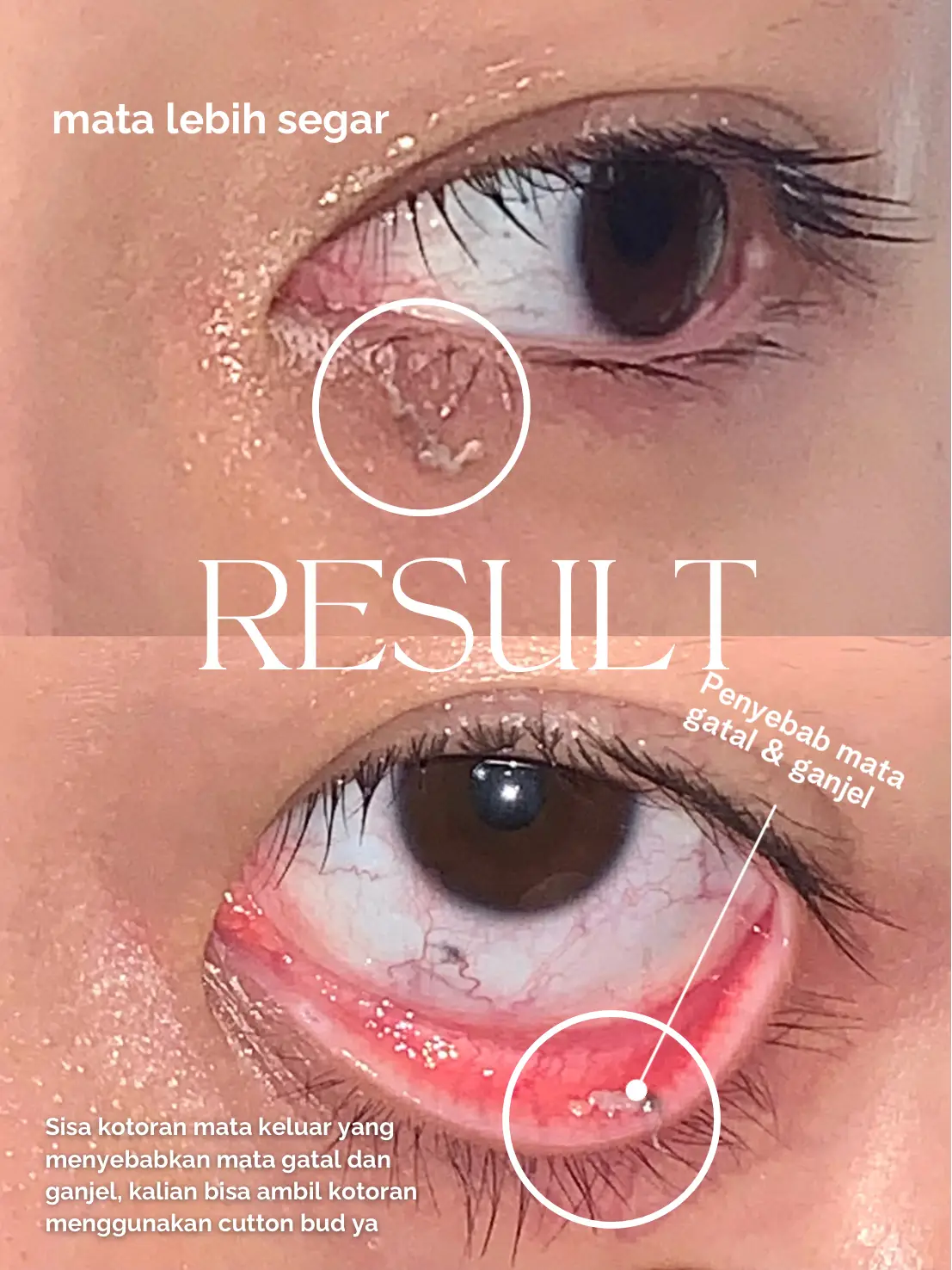 IH ULET ATAU BELEK SI!?😱 MATA SENSITIF WJB PUNYA! | Galeri diposting oleh Charmine🤍 | Lemon8