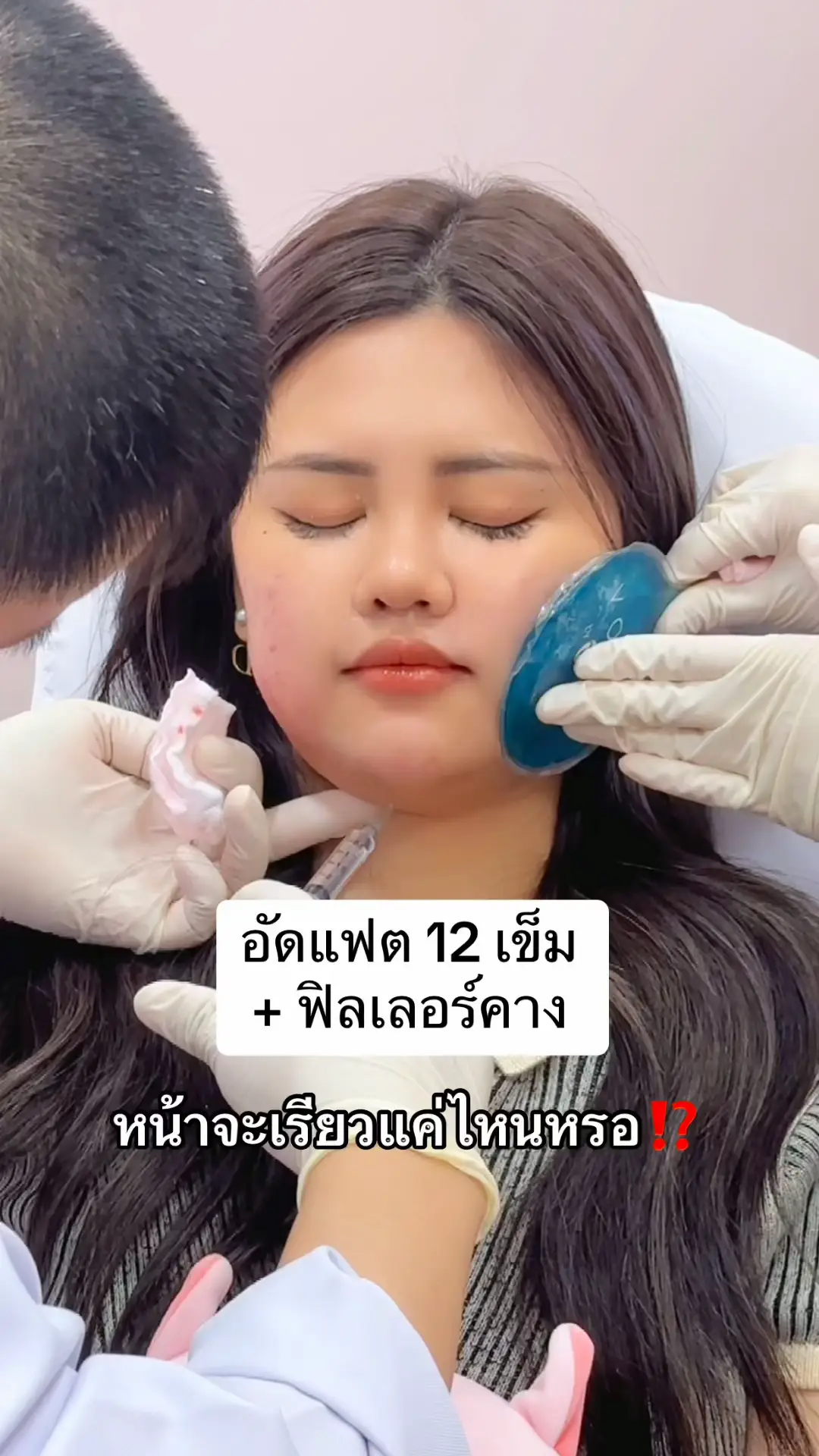 ลองฉีดแฟต 12 เข็ม + ฟิลเลอร์คาง‼️ จะจึ้งจริงมั้ย 😖 | วิดีโอที่เผยแพร่โดย MEGA Beauty | Lemon8