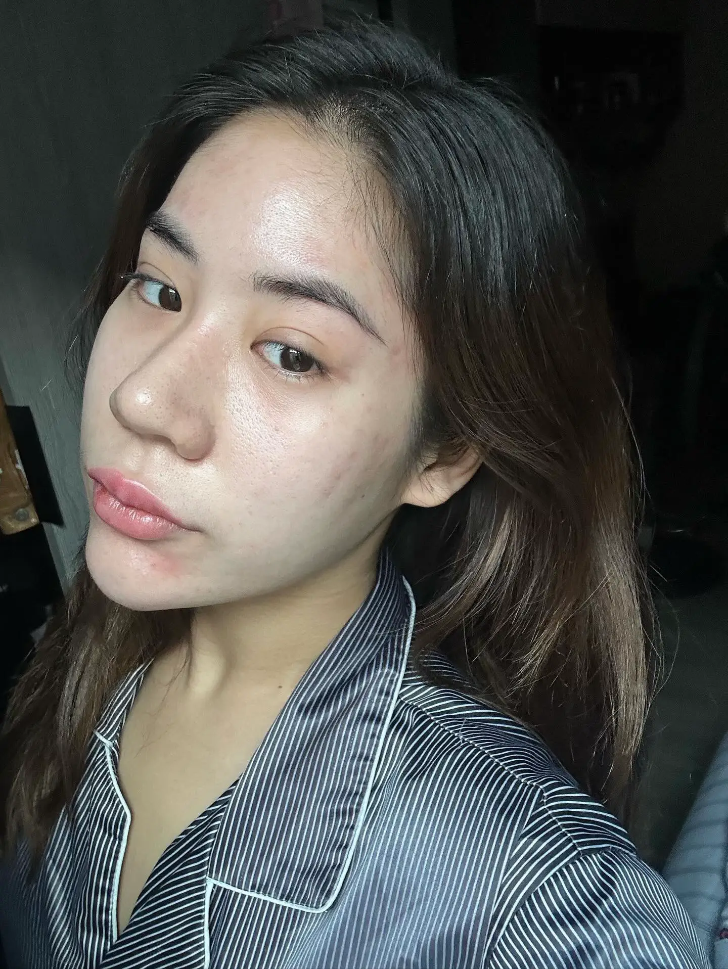 Retinol ดีจริงมั้ย? | แกลเลอรีที่โพสต์โดย cherlin.er | Lemon8