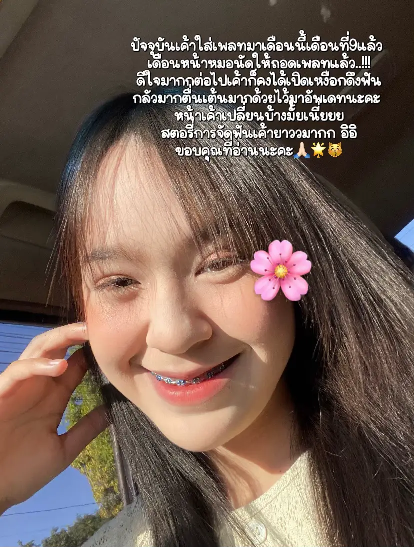 จัดฟันแล้วหน้าเปลี่ยนจริงมั้ย..??? | แกลเลอรีที่โพสต์โดย TANGKWA | Lemon8