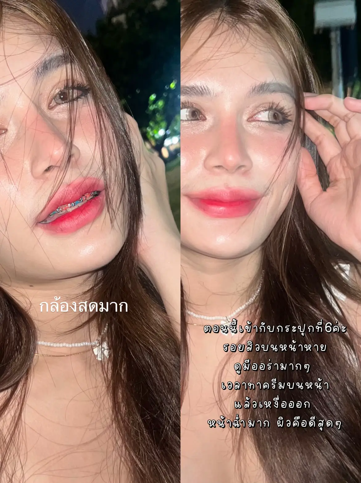เต็ม10ให้เท่าไหร่?กลูต้าตัวดัง เบล็ค เมจิก | แกลเลอรีที่โพสต์โดย ‎ ℎ𝑖 ...