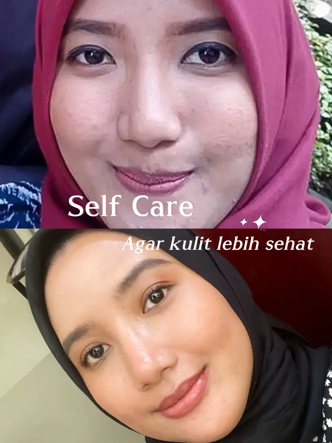Self Care Agar kulit lebih sehat | แกลเลอรีที่โพสต์โดย Ayuderma | Lemon8