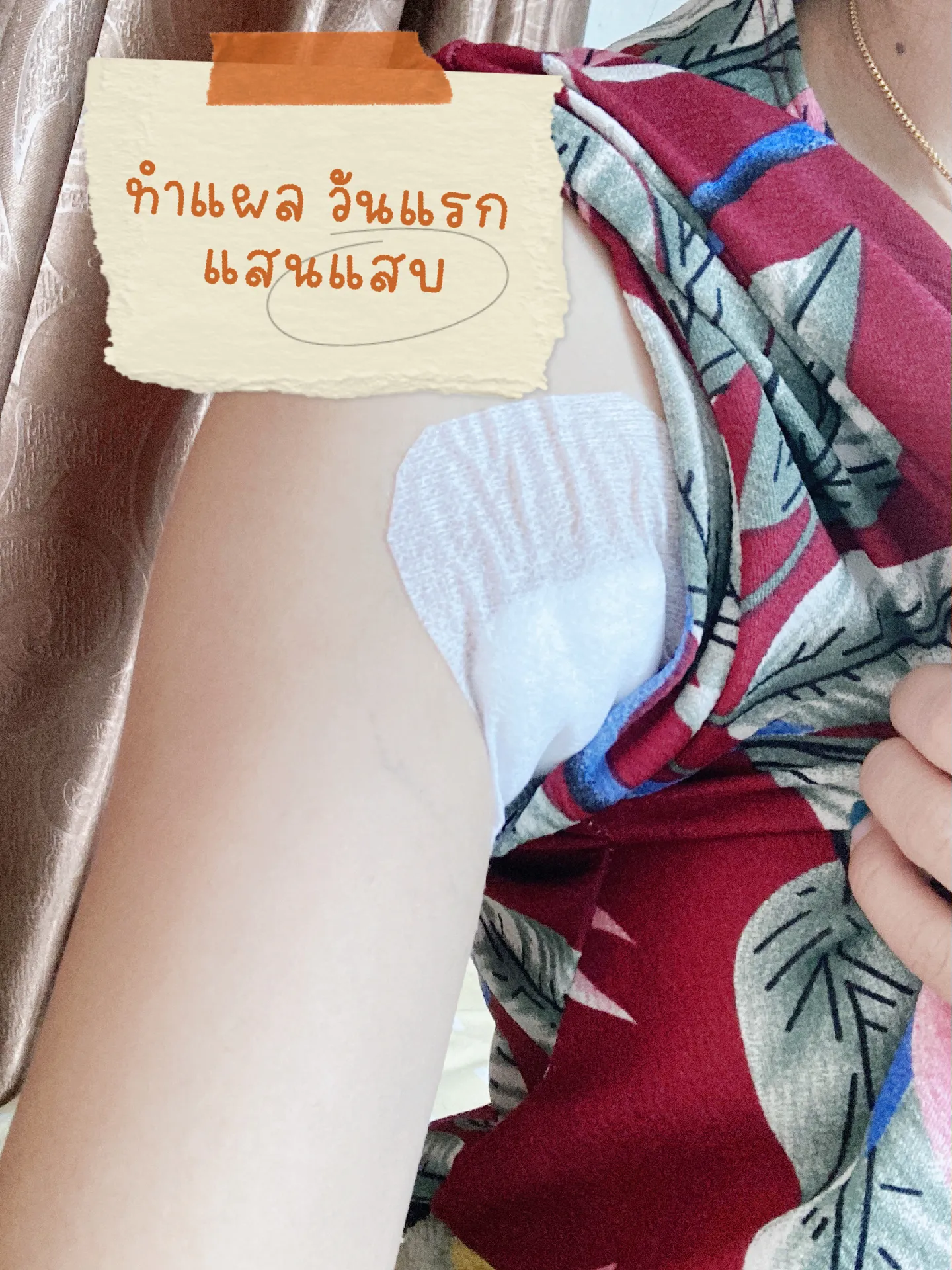 แชร์ประสบการณ์แพ้โรลออน รักแร้ดำมา 17 ปี | แกลเลอรีที่โพสต์โดย Kesinee.K | Lemon8