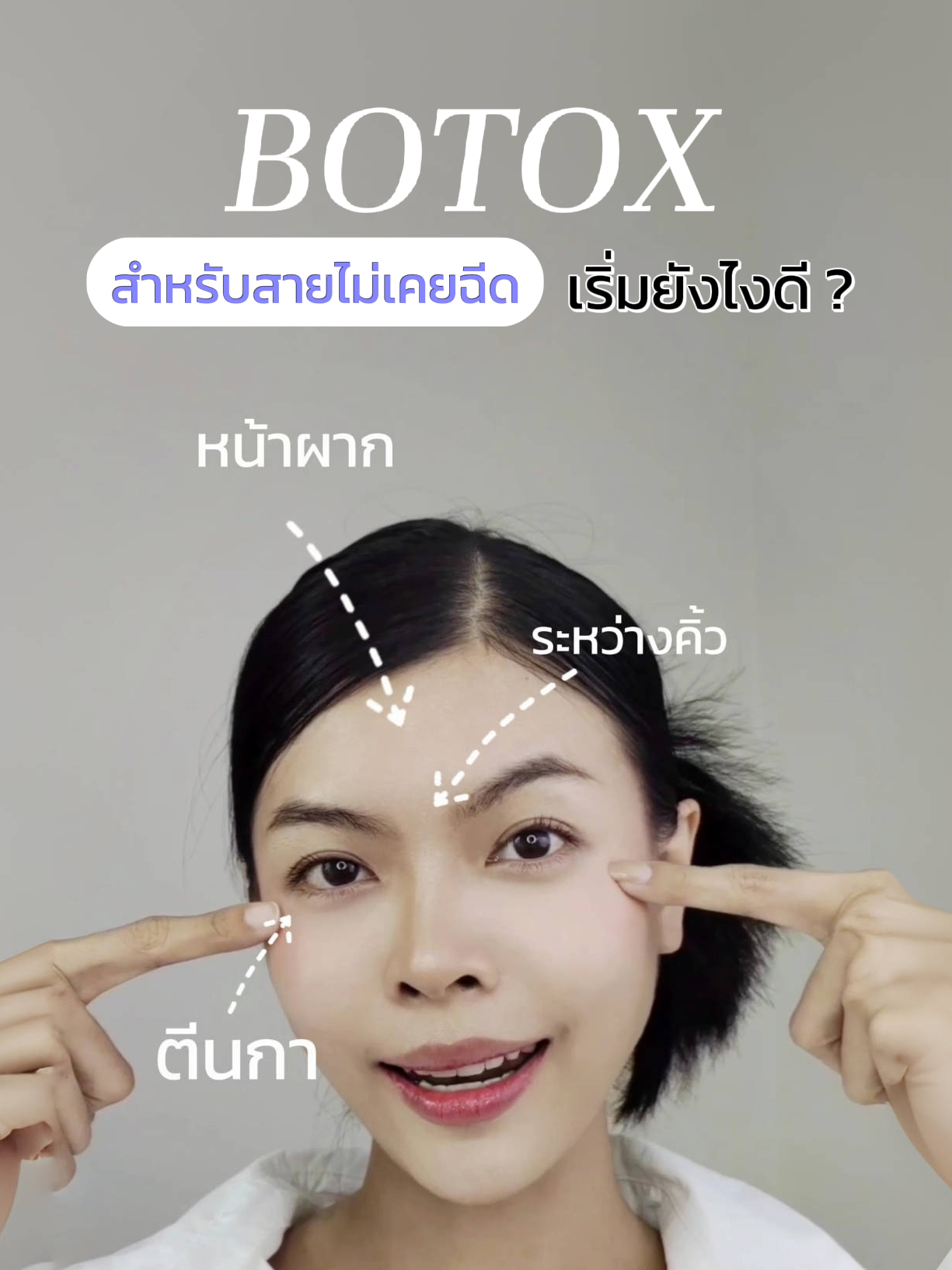 Botox เริ่มฉีดเมื่อไรดี | 2024 ประสบการณ์ผู้ใช้จริงบน Lemon8