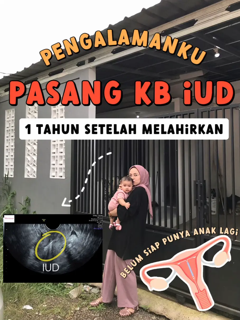 PENGALAMANKU PASANG KB IUD😱😱 | Galeri diposting oleh Derindarsari | Lemon8