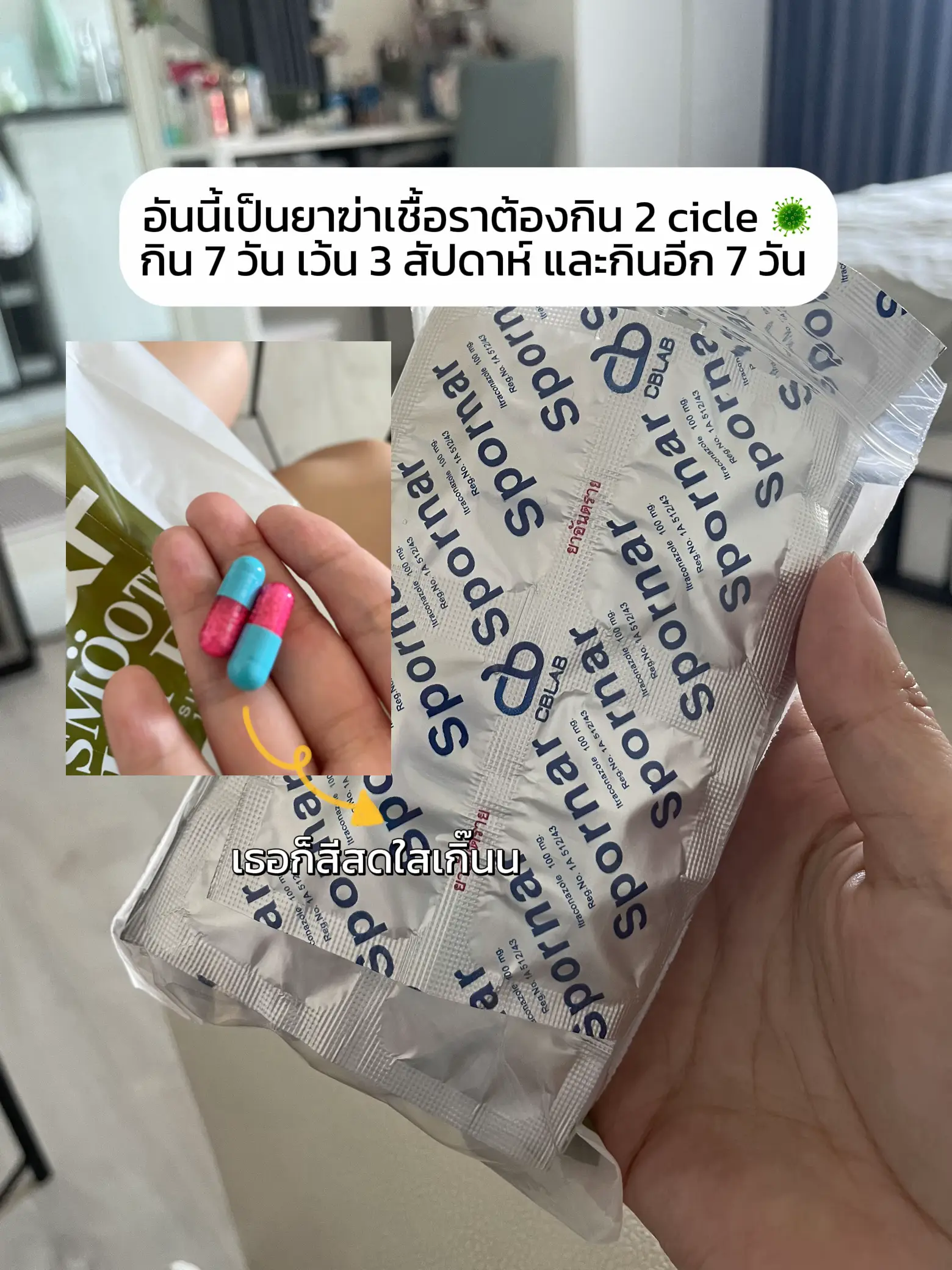 🚨เตือนภัย เล็บเป็นเชื้อรา 🙀 ️ | แกลเลอรีที่โพสต์โดย Chomchom | Lemon8