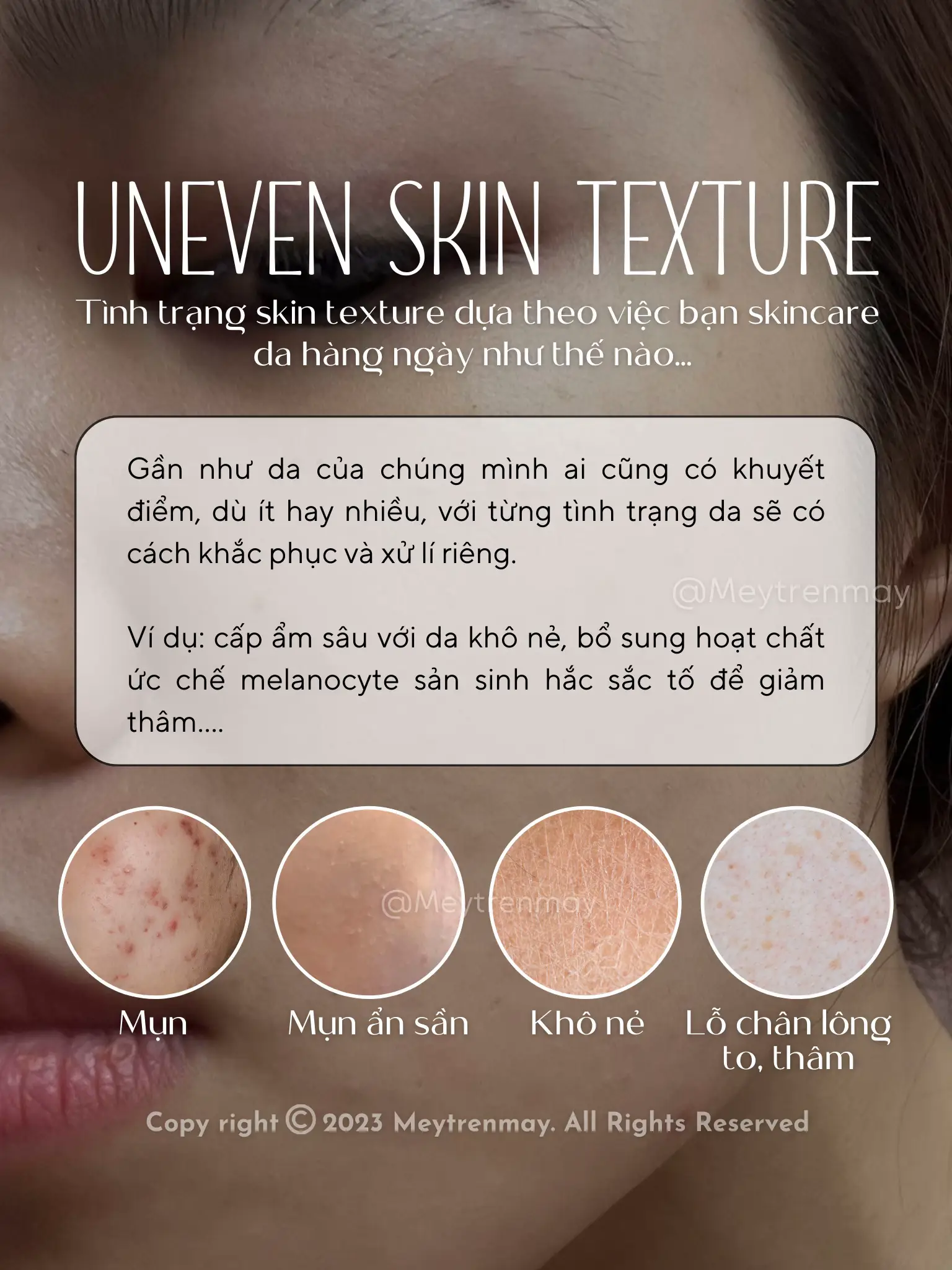 Skin texture - giải đáp lí do da không “căng mọng” | Bộ sưu tập do Mey ...