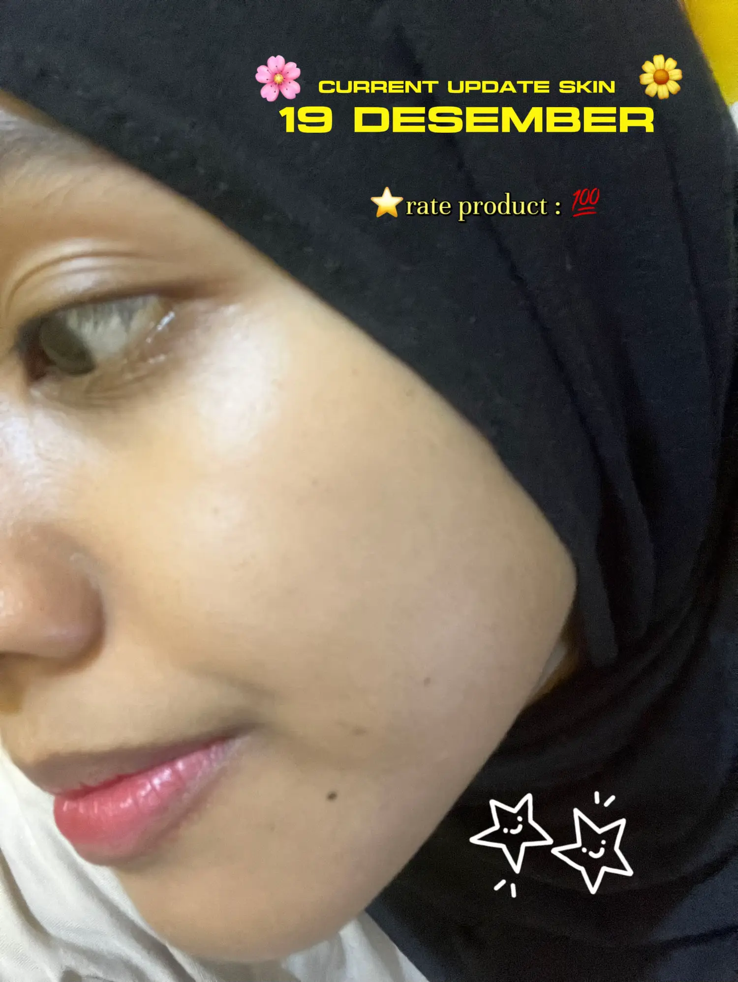 MOISTURIZER HIDDEN GEM🌟 (HEYSKIN MOIST) | Galeri diposting oleh aley🌜 | Lemon8