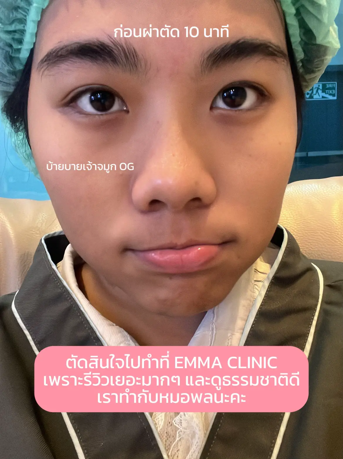 รีวิวการทำจมูกครั้งแรก! ที่ EMMA clinic 🙌 | แกลเลอรีที่โพสต์โดย Mewpich | Lemon8