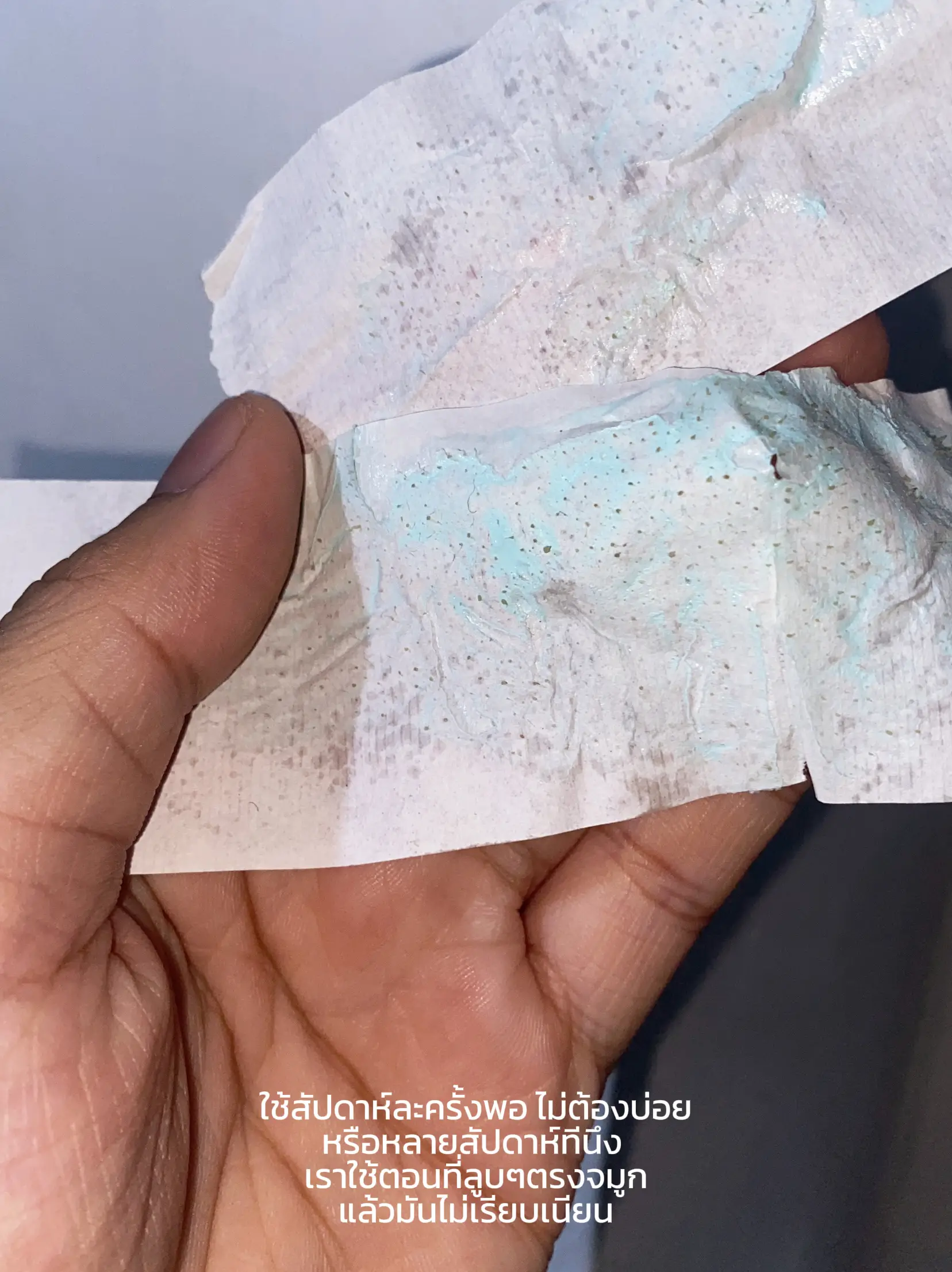 สิวเสี้ยนหลุดกระจุย ! ซองเดียวรู้เรื่อง 🤫 | แกลเลอรีที่โพสต์โดย 𝑃𝑎𝑐𝑘𝑖𝑛𝑔 ᐧ༚̮ᐧ | Lemon8